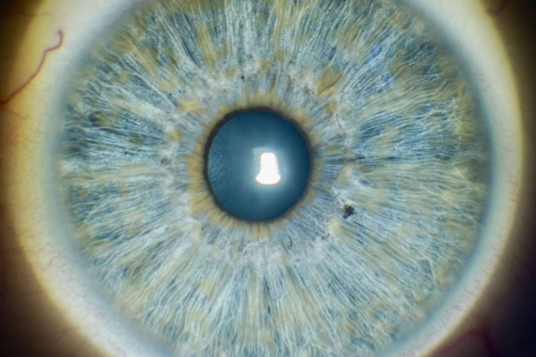 Cambiar el color de los ojos de manera segura y eficaz con la técnica ...